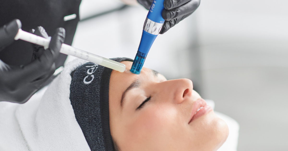 Formation Microneedling & Mésoporation | EAoT Aix en Provence